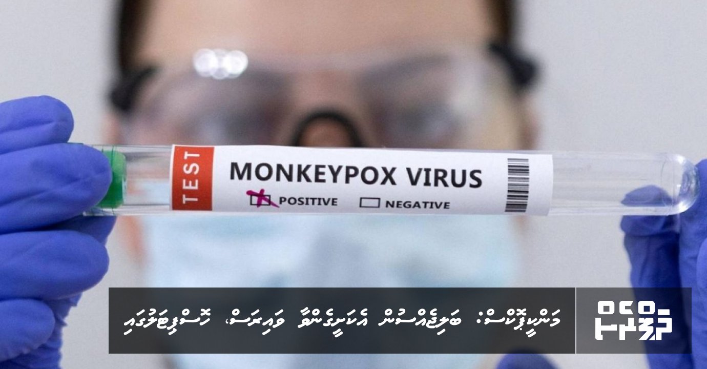 Monkeypox: bali jessun ekashi gen vaa virus, hospital kotari thakugai ...